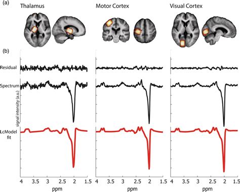 Anatomical Location Of Mrs Voxels Panel A Shows A Heat Plot Of The