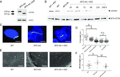 Targeted Exon Skipping Of A Cep290 Mutation Rescues Joubert Syndrome