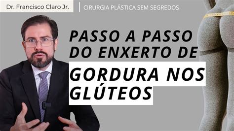 Como é Feita A Lipoenxertia Nos Glúteos Lipoenxertia