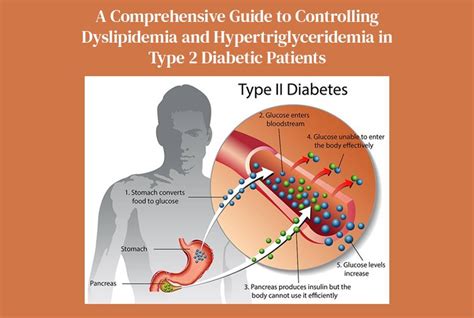 Dyslipidemia And Hypertriglyceridemia Causes And Management