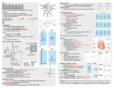 EKG Interpretation Cheat Sheet PDF