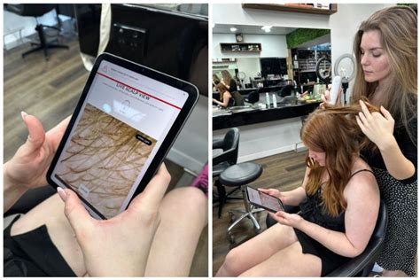 Dandruff Sensitivity And Scalp Concerns Becky B Hair