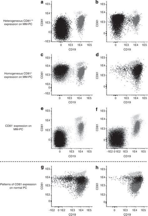 Bivariate Dot Plot Histograms Illustrating The Patterns Of Cd81 Vs Cd19 Bivariate Dot Plot Histograms Illustrating The Patterns Of Cd81 Vs Cd19