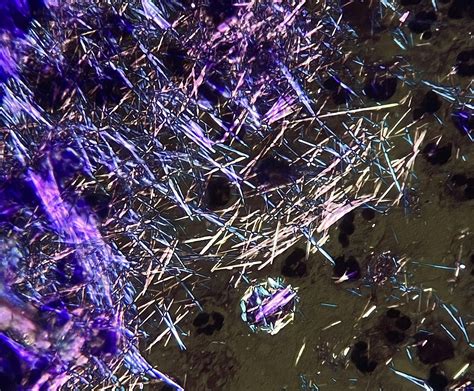 Gout Crystals Under The Microscope [oc] R Pics