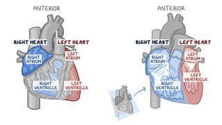 Dextrocardia What Is It Diagnosis Treatment And More Osmosis