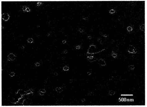 Insulin Nano Transdermal Patch And Preparation Method Thereof Eureka Patsnap