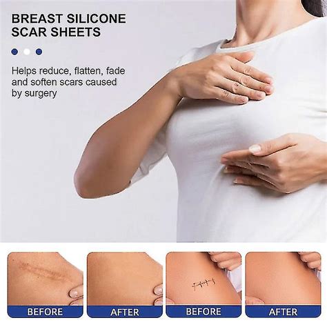 Silicone Scar Sheets Silicone Scar Sheets For Breast 8 Pack Breast Reduction After Surgery For