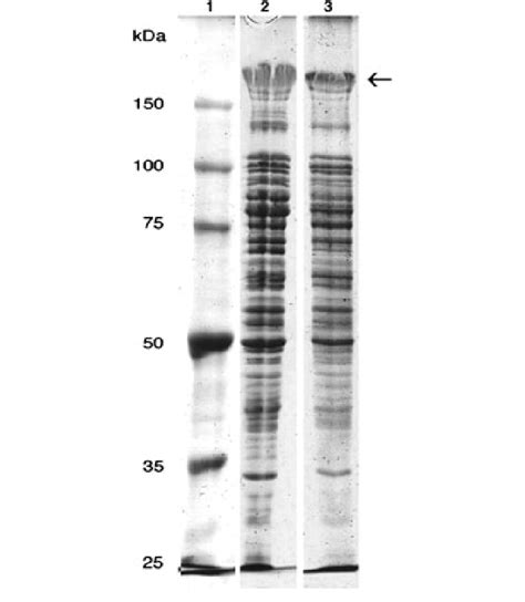Whole Cellular Proteins Of Rods And Spheres Of Halobacterium Salinarum