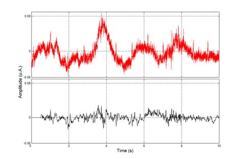 noise removal from eeg signals in polisomnographic records applying adaptive filters in cascade