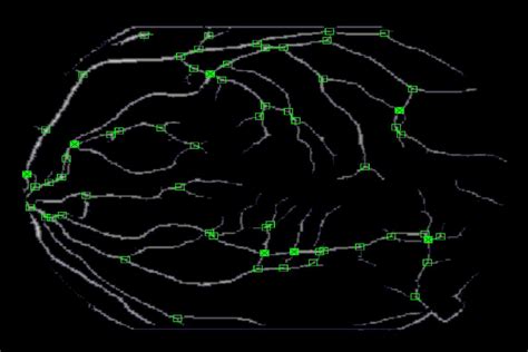 Geometrical Features Of Retina 1 A And Conjunctiva 1 B Images Download Scientific Diagram
