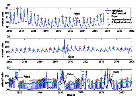 A Novel Approach To Detecting Pulse Onset In Photoplethysmographic Signal Using An Automatic Non