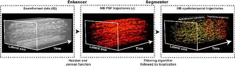 Figure 1 From A Tracking Prior To Localization Workflow For Ultrasound Localization Microscopy