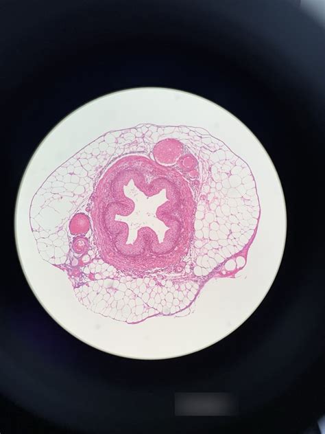 Ureter Slide Diagram Quizlet