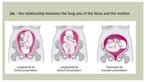 Leopolds Maneuver Part 1 Nnursing Sttudents Ppt
