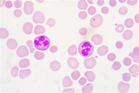 분할된 Netrophil 2015년에 대한 스톡 사진 및 기타 이미지 2015년 건강관리와 의술 골수구 Istock