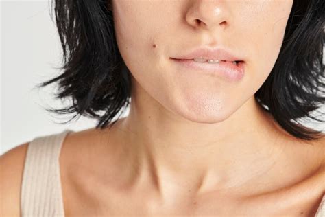 Angular Cheilitis Prevention Causes And Effective Treatment
