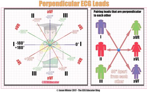Ecg Educator Blog Cardiac Axis Made Easy