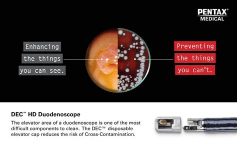 Endoscopy Ercp Scope Duodenoscope Pentaxmedical Mdrd Ipac