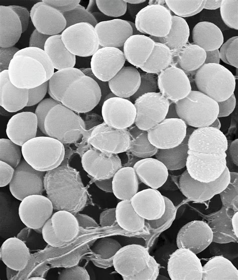 Staphylococcus Haemolyticus Photograph By Science Photo Library