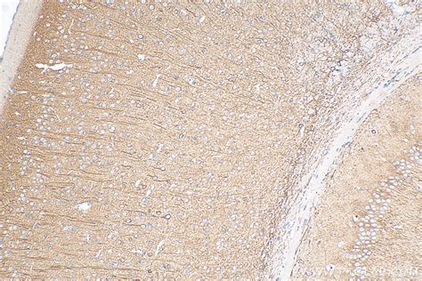 Map2 Antibody 17490 1 Ap Proteintech