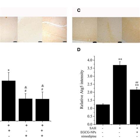 Figure Optimization Of Egcg Nps Particle Size Distribution Of Egcg Nps