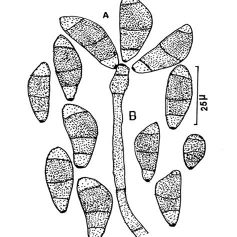 Pithomyces Sacchari A Conidia B Conidiophores Download Scientific Diagram