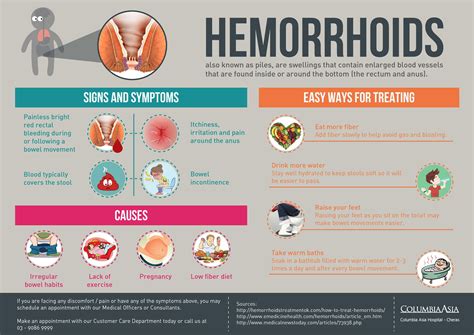 What Causes External Hemorrhoids