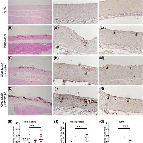 Representative Photographs Of Medial Vascular Calcification Assessed By Download Scientific