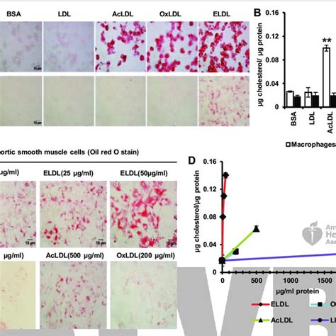 Enzyme Modified Low Density Lipoprotein Eldl Endocytosis By Aortic Download Scientific