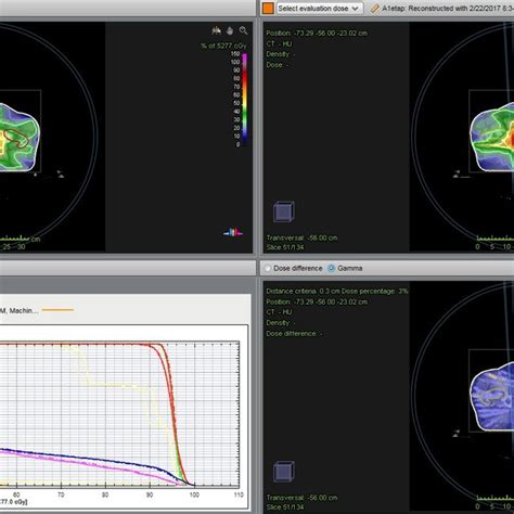 3d Gamma Index Gi Analysis In The Compass System On A Patients Ct
