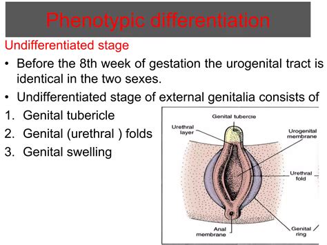 Disorders Of Sex Development Pptx