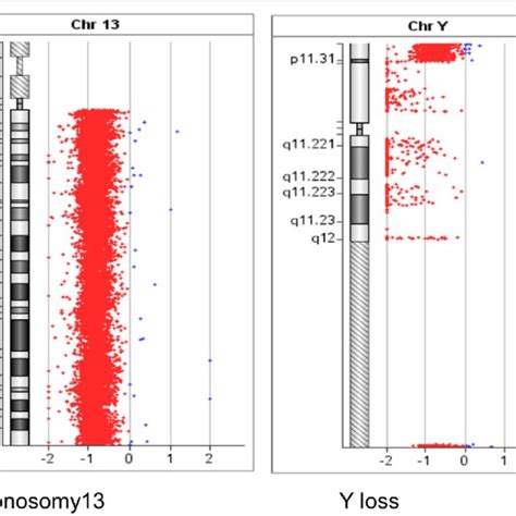 Cgh Array Analysis Showing Loss Of Complete Chromosomes 13 And Y Red