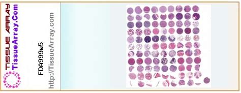 Fda999w5 Multi Organ Normal Human Tissues Array Representing Fda Guideline For Antibody Cross