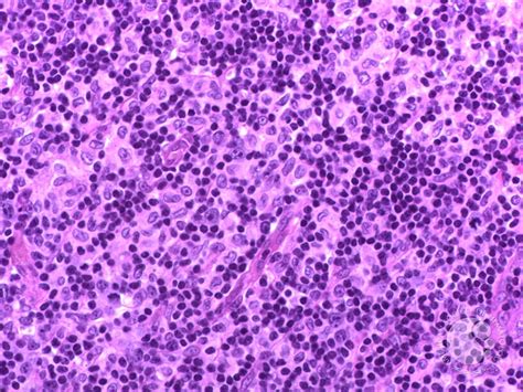 Normal Lymphoid Tissues Part 3 6