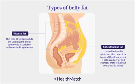 Healthmatch Belly Fat And Your Risk Of Metabolic Diseases — Is It