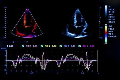 Fpga Solution Stacks Microchip Technology