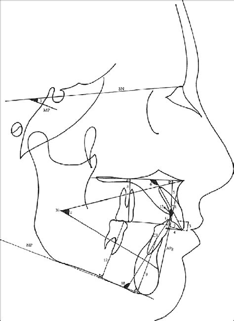 Fig Cephalometric Landmarks Download Scientific Diagram
