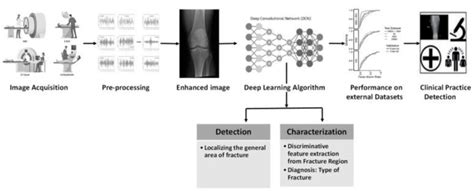 Detection Of Bone Fracture Using Mri 6 Download Scientific Diagram