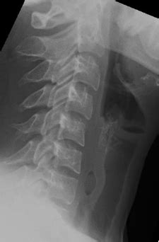 Soft Tissue Neck X Ray Anatomy 1920x1080
