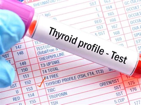 Enlarged Thyroid Enlarged Thyroid Symptoms