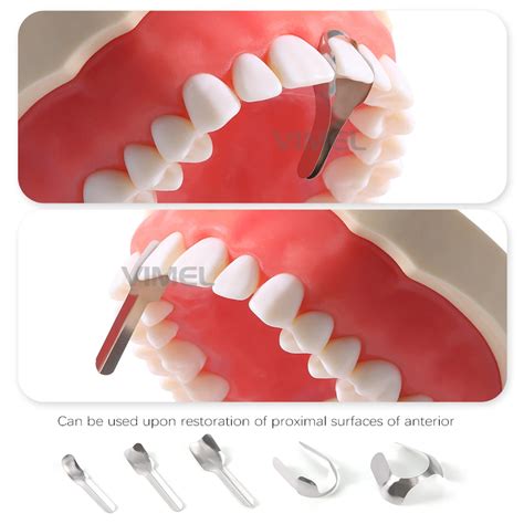 Dental Proximal Anterior Strips Twin Anterior Matrices Matrix Tooth