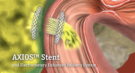 Gastroenterology Education Boston Scientific Educare