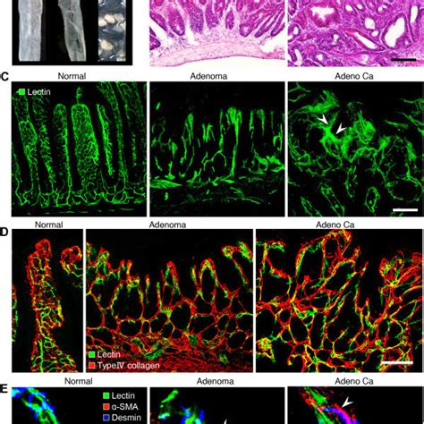 Tomato Lectin Staining Of Functional Tumor Vessels In Gastrointestinal Download Scientific