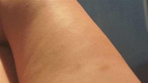 Bruises And Thighs Show For Now Wmv Crazy Fetish Diva Clips4sale