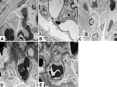 Electron Micrographs Of The Renal Glomeruli In The Different Rats