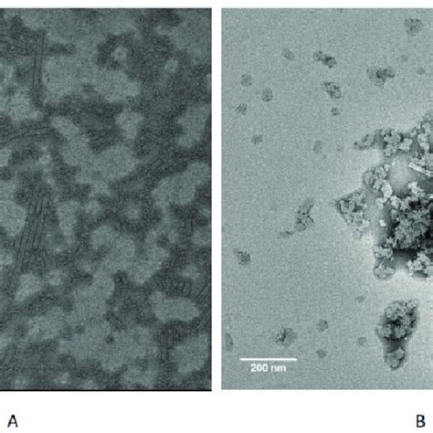 Tmv Rod Assembly Inhibition Of Compound 14b 200 Nm Scale Bar A 20s Download Scientific