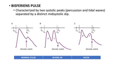 Pulse Arterial Pulse Types Pptx Heart And Cardiovascular
