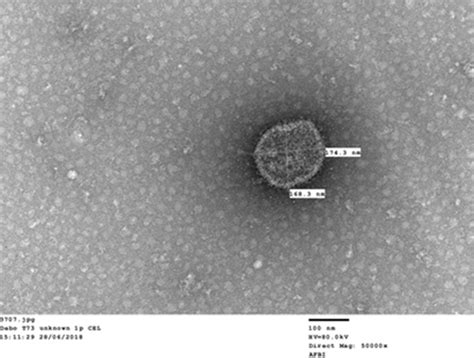 Pleomorphic Virus Like Particle With Surface Projections Observed By Download Scientific