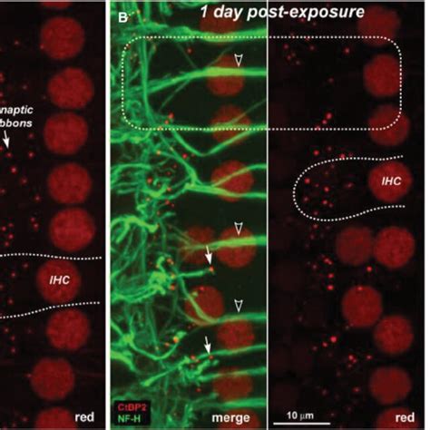 Schematic Depiction Of Cochlear Sensory Epithelium Showing Inner