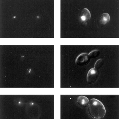 Localization Of Stu2pgfp Fusion Protein Gfp Fluorescence Was Download Scientific Diagram